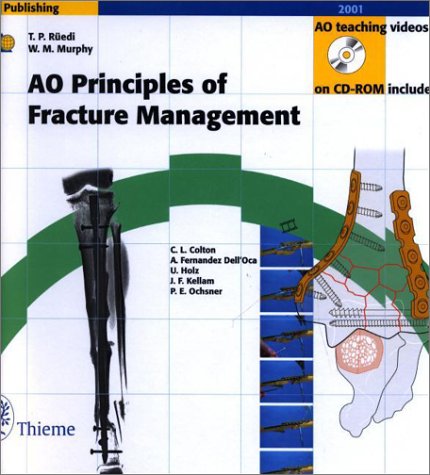AO Principles of Fracture Management (Book with CD-ROMs + DVD ...