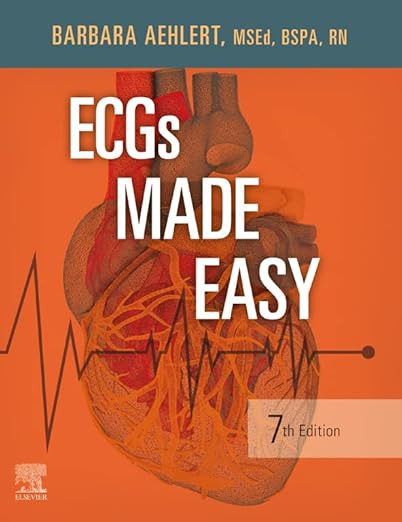 Amazon.com: ECGs Made Easy - E-Book eBook : Aehlert MSEd, BSPA, RN ...