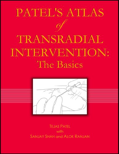 Patel's Atlas of Transradial Intervention: The Basics: Dr. Tejas Patel ...