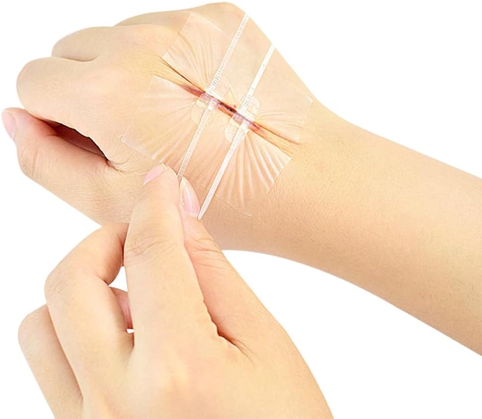 Amazon.com: Sutures Adhesive Bandages 2 PCS Surgical Laceration Repair ...