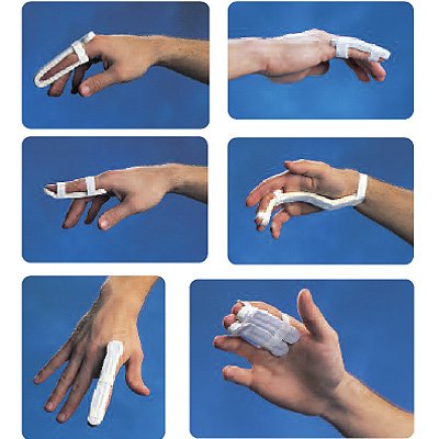 Amazon.com: Plastalume Finger Splints - 3 1/4" (83mm) (AB-4) Pack of 12 ...