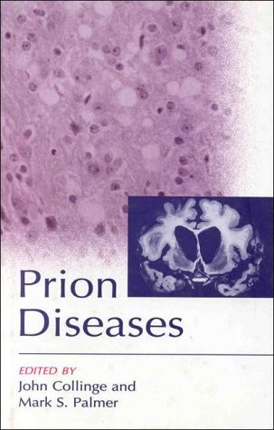 Amazon | Prion Diseases | Collinge, John, Palmer, Mark S. | Neurology