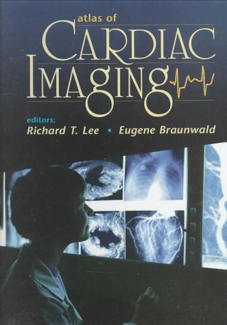 Atlas of Cardiac Imaging: Lee MD, Richard T., Braunwald MD MD(Hon) ScD ...