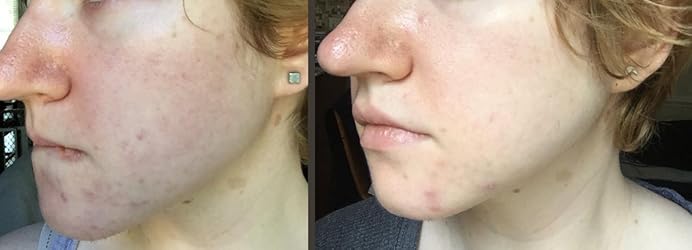 Amazon.com: Ecological Formulas Melazepam Cream, 2 Ounce (Pack of 1 ...