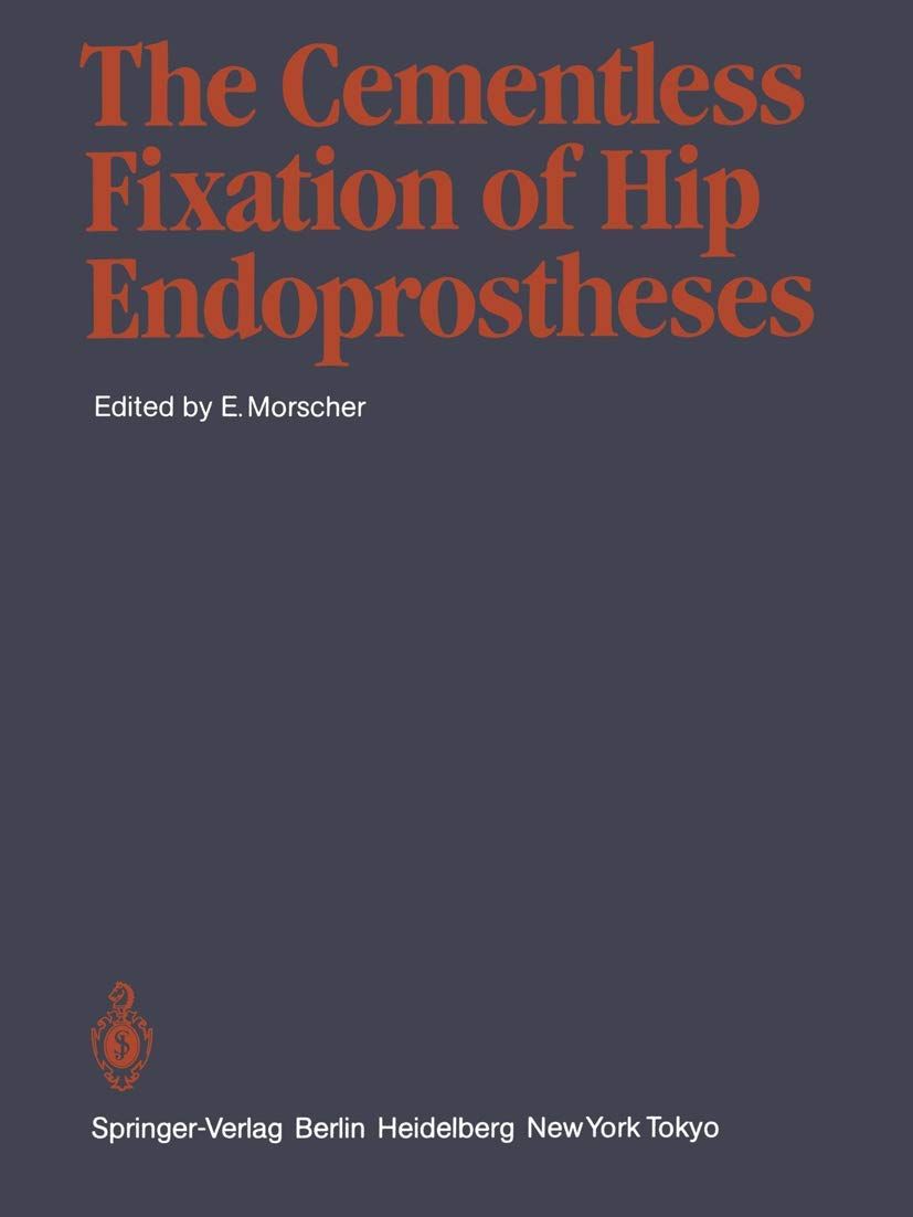The Cementless Fixation of Hip Endoprostheses: 9783540122548: Medicine ...
