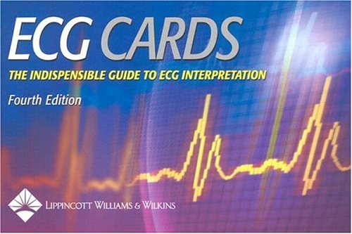 ECG CARDS: The Indispensible Guide to ECG Interpretation: Springhouse ...