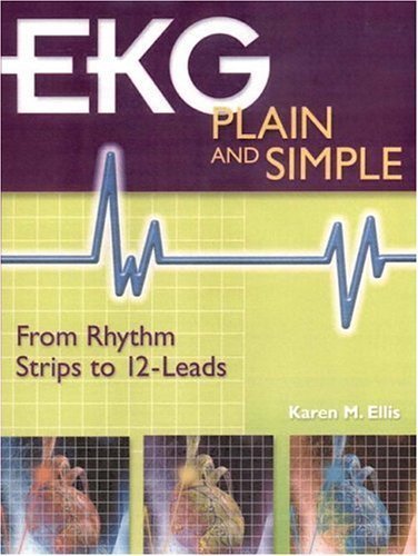 EKG Plain and Simple: From Rhythm Strips to 12-Leads: Ellis, Karen ...
