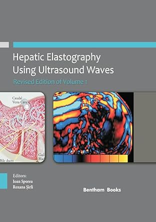 Amazon.in: Buy Hepatic Elastography Using Ultrasound Waves Revised ...