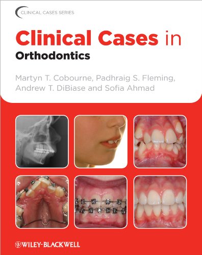 Clinical Cases in Orthodontics (Clinical Cases (Dentistry)) - Kindle ...