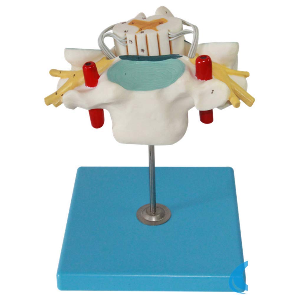Teaching Model A Magnified Model Of The Human Cervical Spinal ...