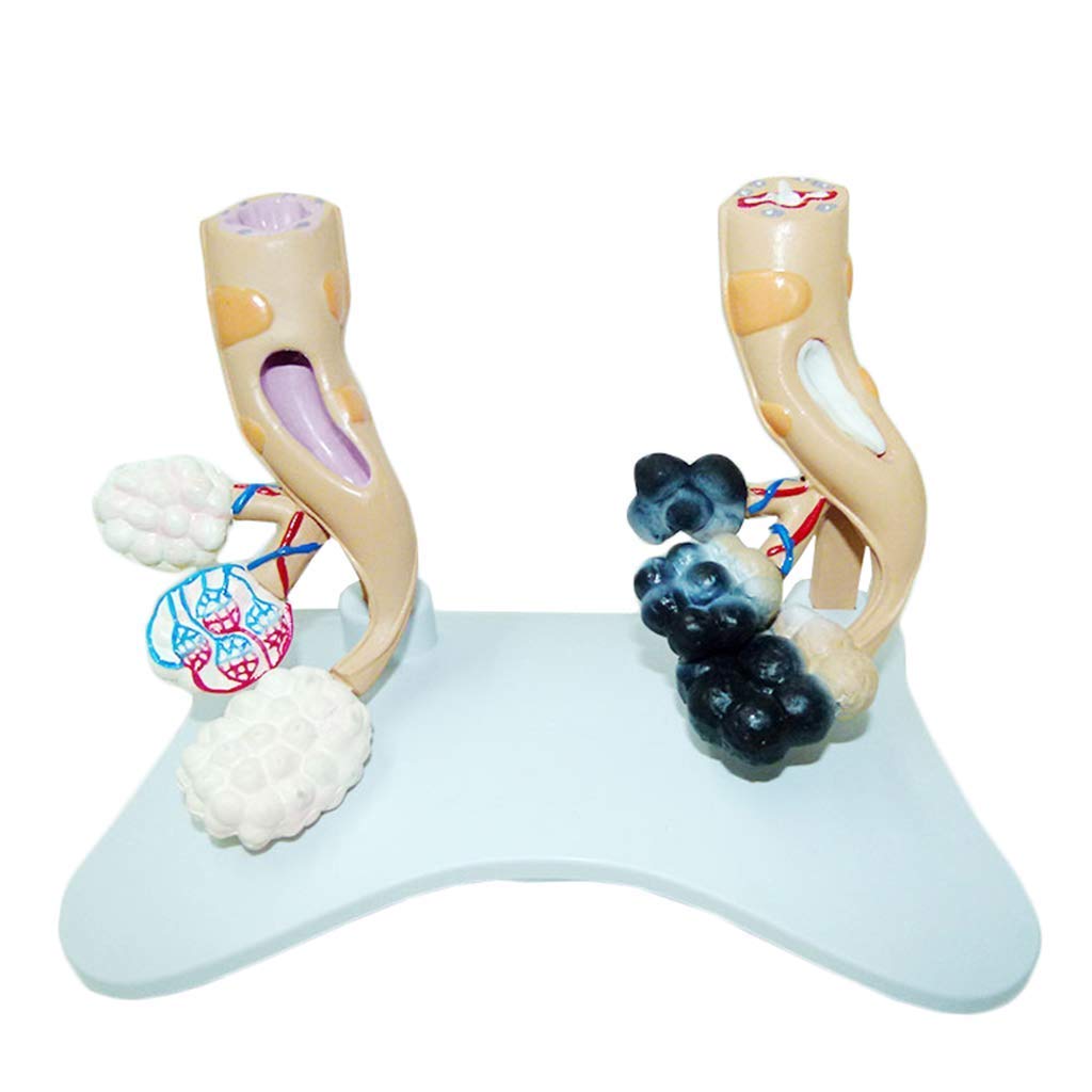 Buy Alveolar Model - Human Organ Anatomical Model - Comparative Smoking ...