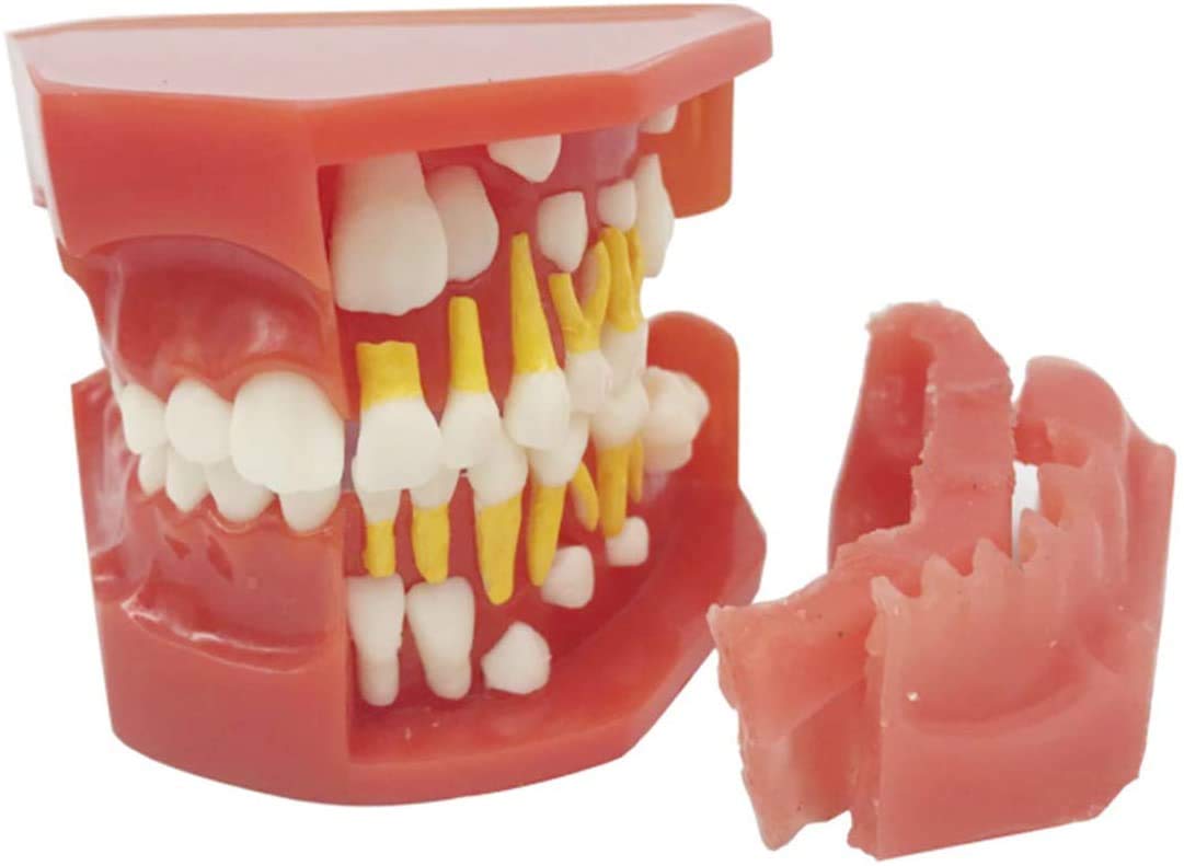 Bbyt Removable Deciduous Teeth Model Dental Children Human Anatomy ...