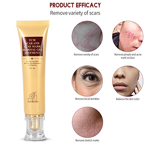 30g Acne Face Cream, Anti-Acne Pimple Treatment Cream Shrink Pores Oil ...