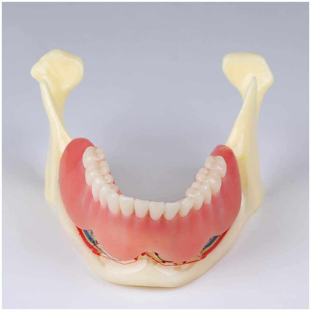 Buy Teeth Teaching Model - Denture Im And Restoration Anatomical Jaw ...