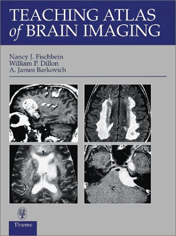 Teaching Atlas of Brain Imaging (Teaching Atlas Series): 9780865778627 ...