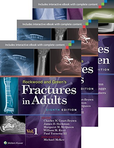 Amazon.co.jp: Rockwood, Green, and Wilkins' Fractures in Adults and ...