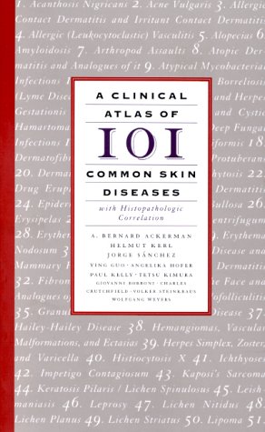 Clinical Atlas of 101 Common Skin Diseases With Histopathologic ...