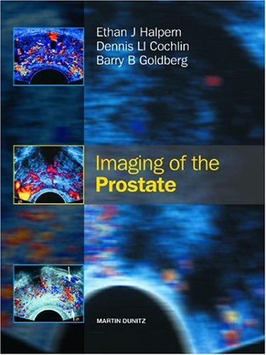 Imaging of the Prostate: 9781841841984: Medicine & Health Science Books ...