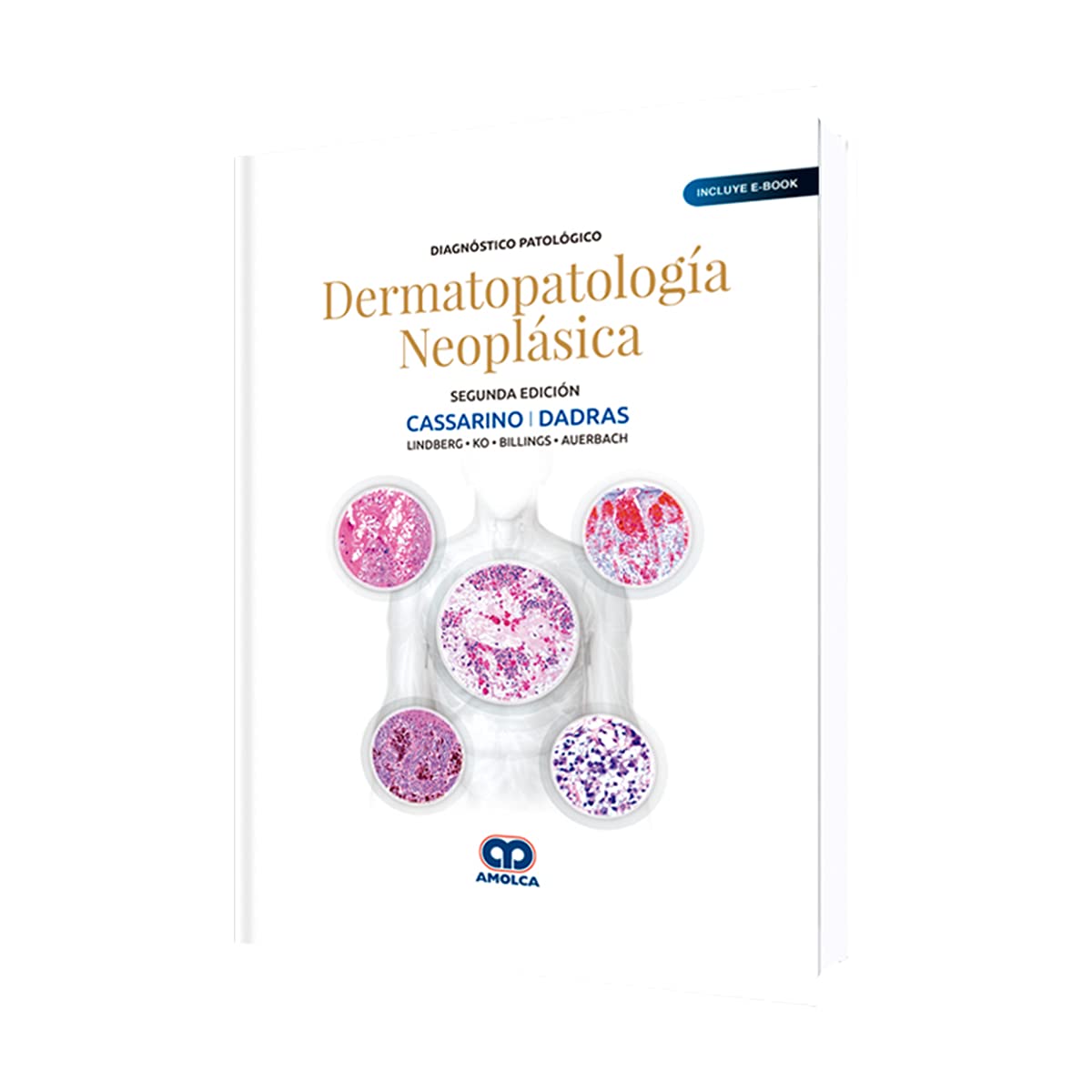 DIAGNOSTICO PATOLOGICO. DERMATOPATOLOGIA NEOPLASICA (INCLUYE E-BO ...
