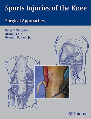 Sports Injuries of the Knee: Surgical Approaches: Peter Simonian ...