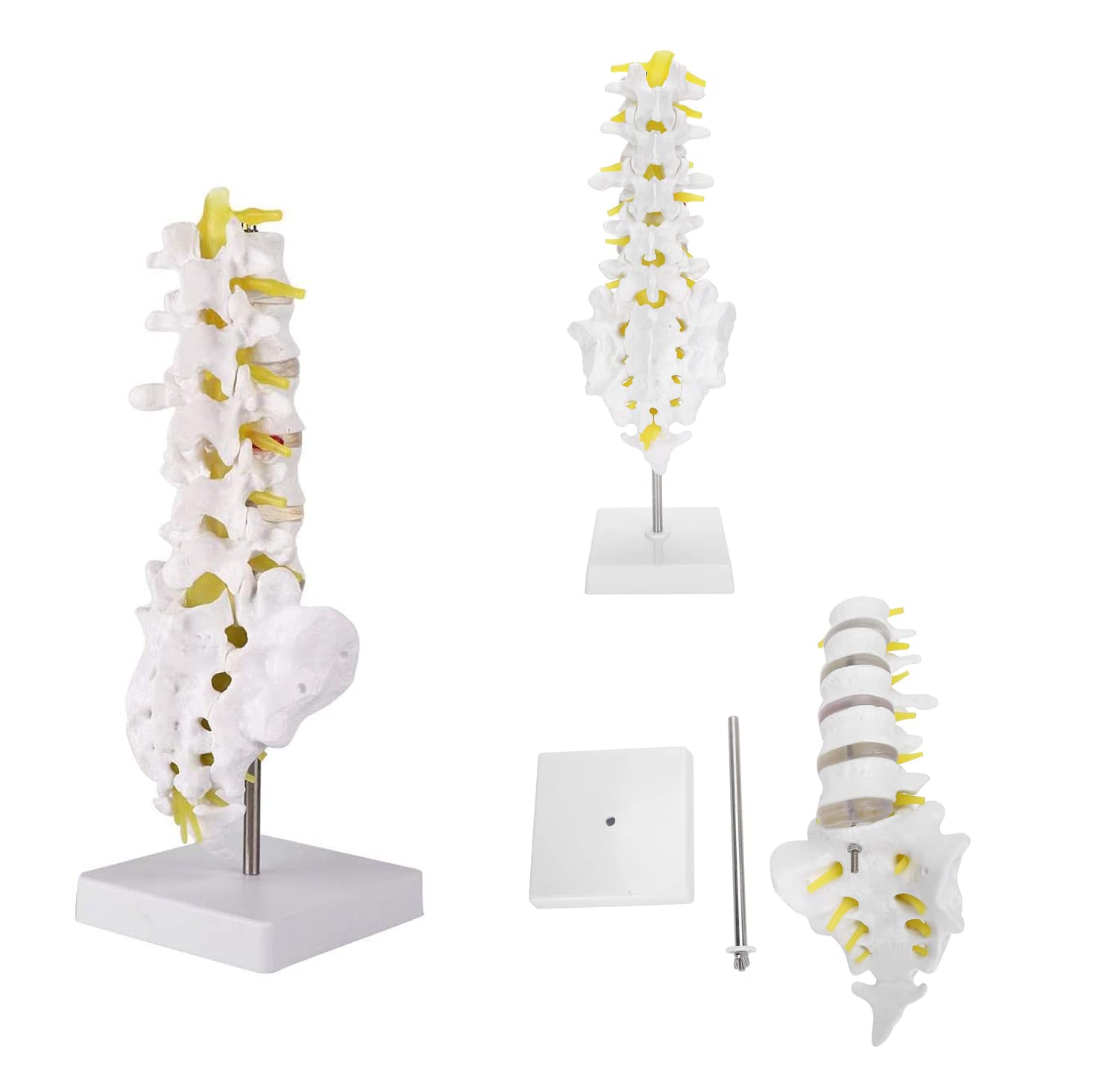 Vertebrae Model 1.5X Magnified Lumbar Disc Herniation Spine Model ...