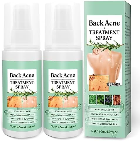 Amazon.com: Back Acne Treatment With Herbal Formula, 2% Salicylic Acid ...