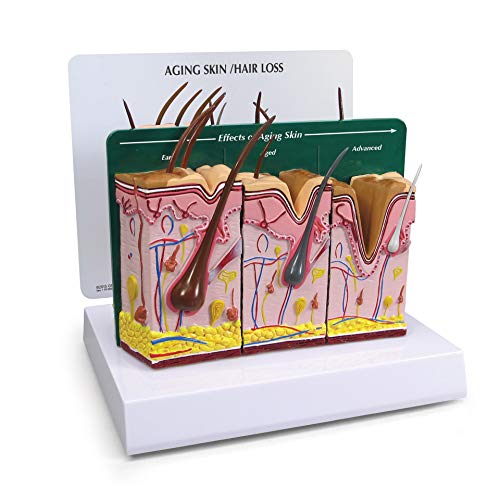 Aging Skin/Hair Loss Model | Human Body Anatomy Replica of Aging Skin w ...