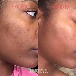 Amazon.com: Ecological Formulas Melazepam Cream, 2 Ounce (Pack of 1 ...