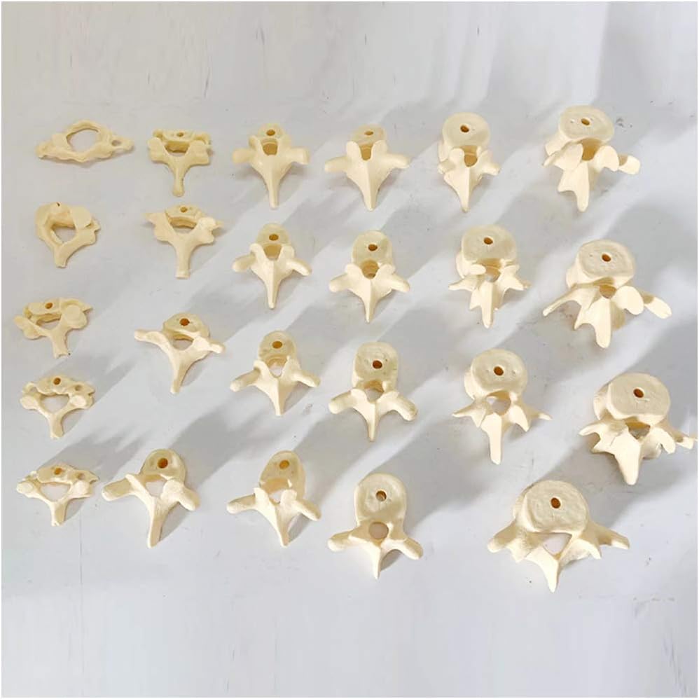 Amazon.com: Scattered Spine Bone Model - Educational Model Human Spine ...