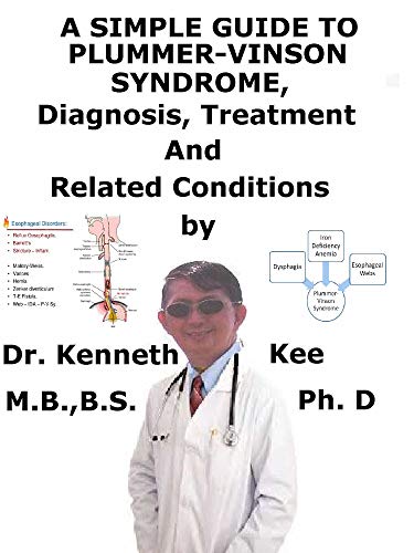 A Simple Guide To Plummer-Vinson Syndrome, Diagnosis, Treatment And ...