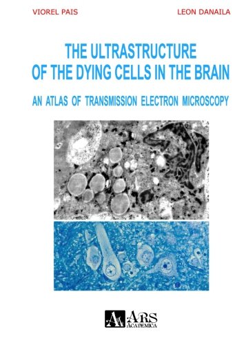 The Ultrastructure of the Dying Cells in the Brain. An Atlas of ...