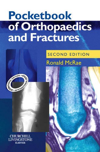 Pocketbook of Orthopaedics and Fractures: McRae: 9780443102738: Amazon ...