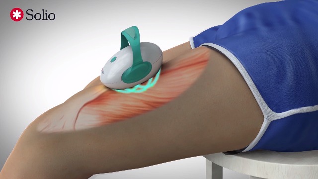 Watch Pain Relief Device | Solio Alfa Plus on Amazon Live