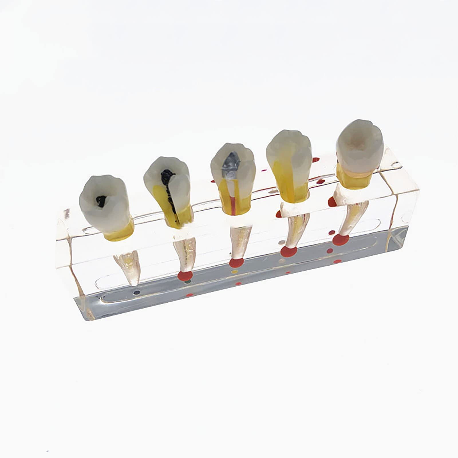 Buy Dental Teaching Demonstration Model, Detachable Pulp Body ...
