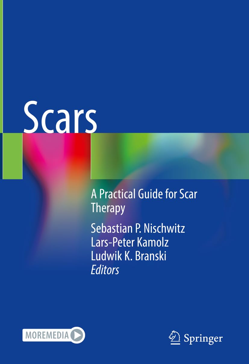 Scars: A Practical Guide for Scar Therapy: 9783031241369: Medicine ...