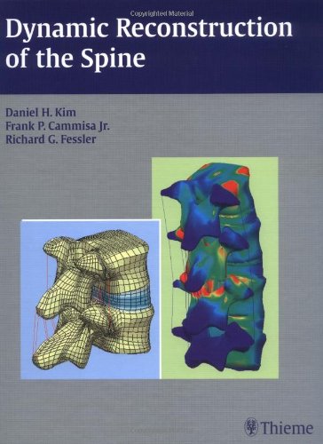 Amazon | Dynamic Reconstruction of the Spine | Kim MD., Daniel H ...