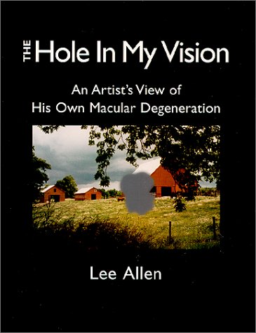 The Hole in My Vision: Lee Allen: 9781572160842: Amazon.com: Books