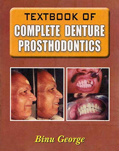 Amazon.com: Textbook of Complete Denture Prosthodontics eBook : George ...
