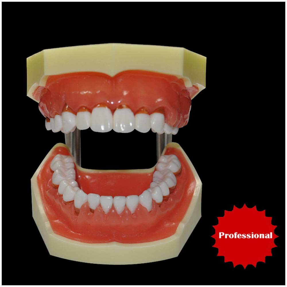 Buy FHUILI Periodontal Disease Teeth Model - Dental Teeth Study ...