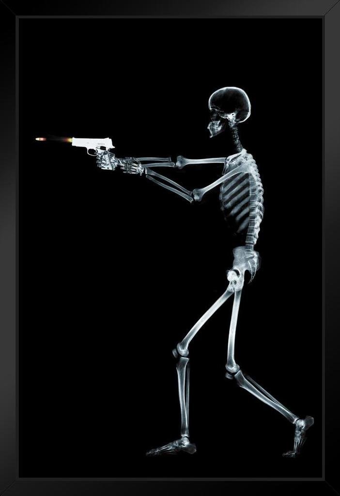 X Ray Skeleton Wallpaper X Ray Radiography Of Human Body (skeleton)