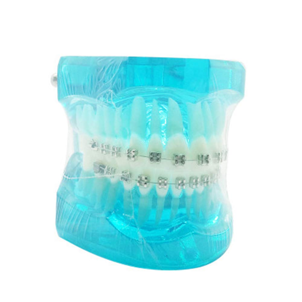 Buy Teeth Model with Brackets Buccal Tube Dental Orthodontic ...