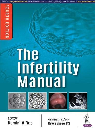 The Infertility Manual: Rao, Kamini a: 9789352701575: Education ...