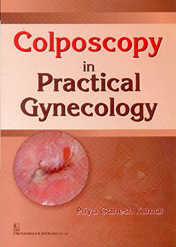 Colposcopy in Practical Gynecology: Priya Ganesh Kumar: 9788123928364 ...