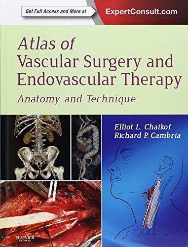 Atlas of Vascular Surgery and Endovascular Therapy: Anatomy and ...