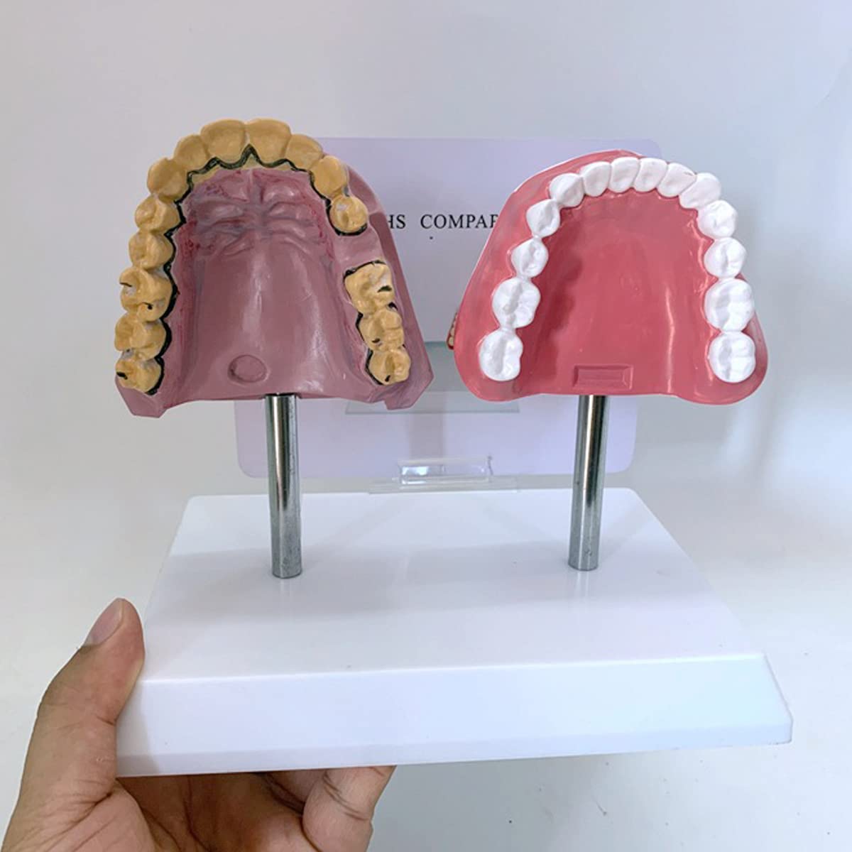 Buy YHDL Tooth Science Model, Human Smoking Teeth and y Teeth ...