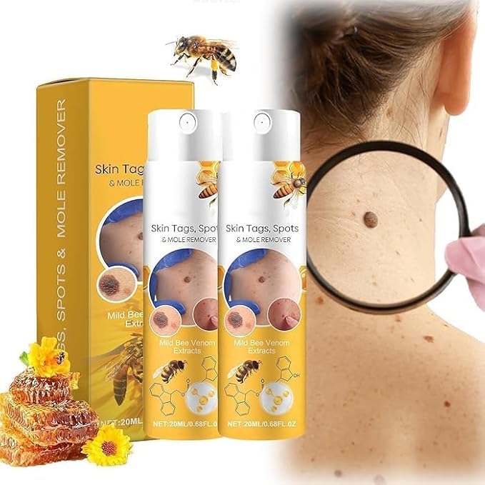 MAMMA VITA Bee Venom Tag Removal Spray,Wree Bee Venom Wart and Tag ...