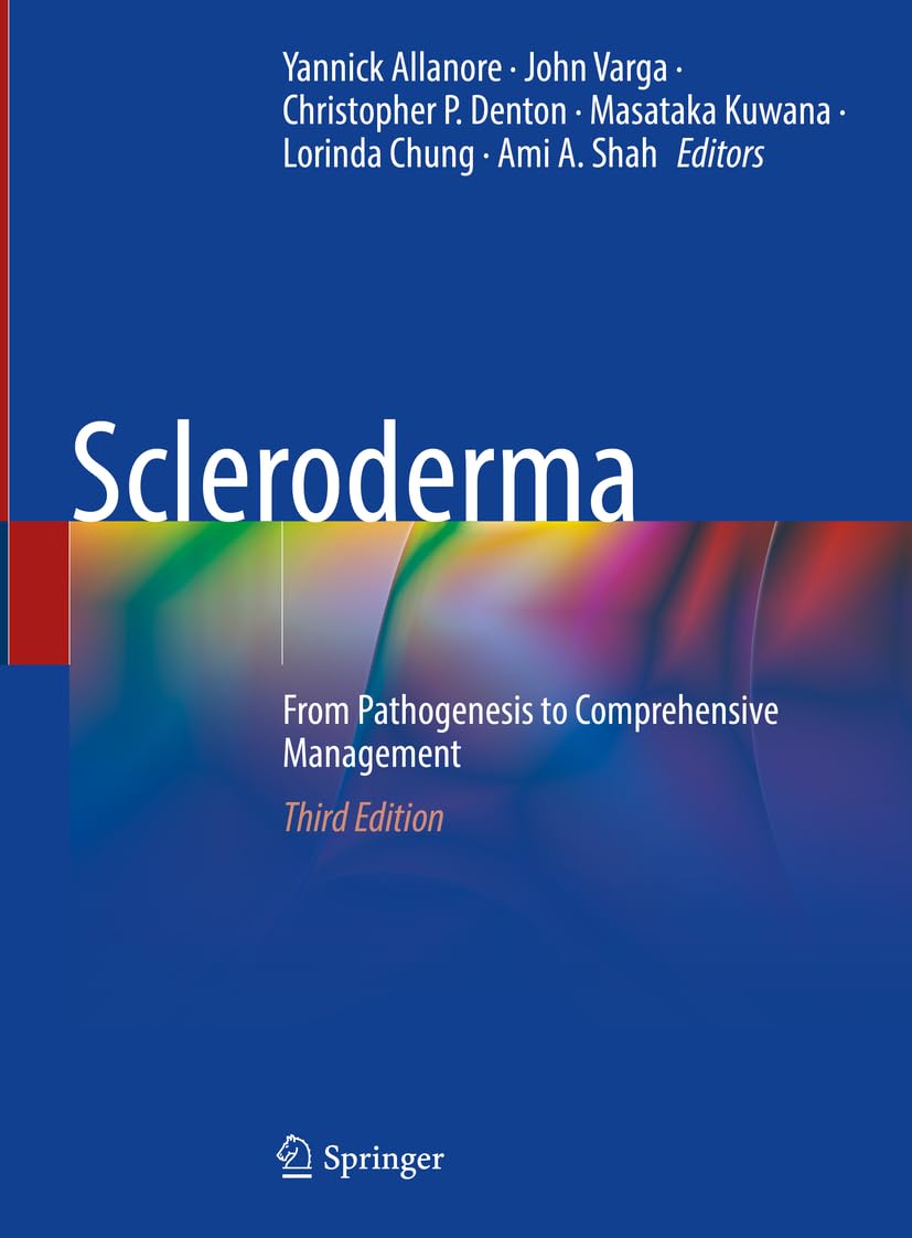 Scleroderma: From Pathogenesis to Comprehensive Management: Amazon.co ...