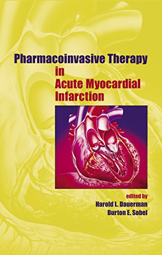 Pharmacoinvasive Therapy in Acute Myocardial Infarction (Fundamental ...