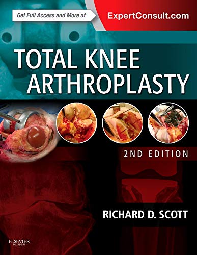 Total Knee Arthroplasty: Amazon.co.uk: Scott MD, Richard D ...