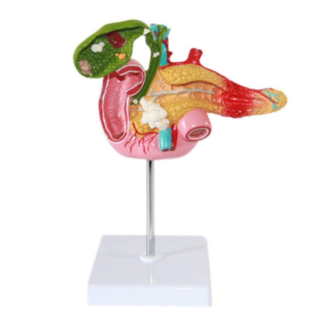 Buy XDXDO Medical Human Stomach And Gallbladder Pancreas Duodenum Model ...